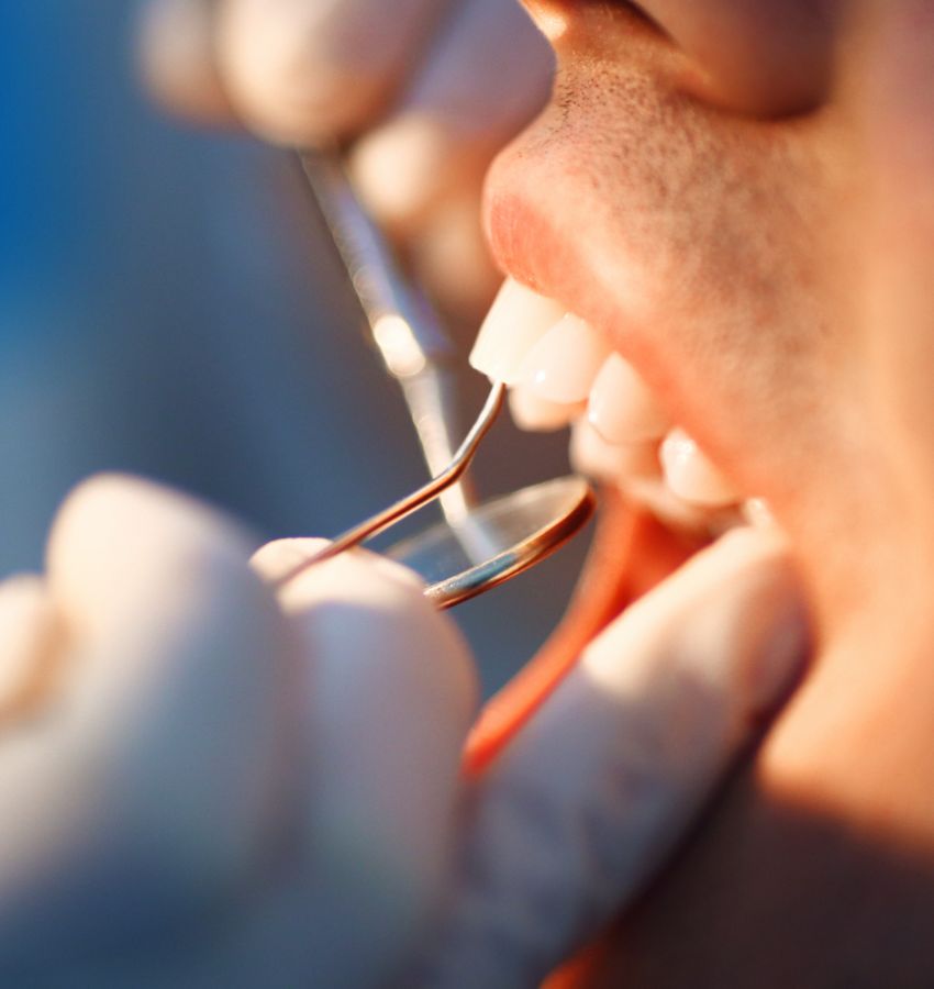 Dental Bonding in Hallam and East York, PA
