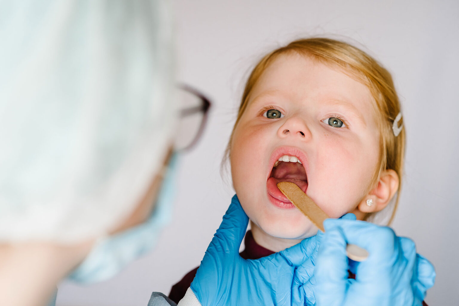 Long Term Risks Of Untreated Lip Tongue Ties Cdepa